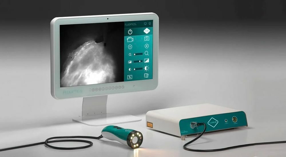 Флуоресцентна ангіографія з камерою FLUOPTICS | Відео Lancet Clinic